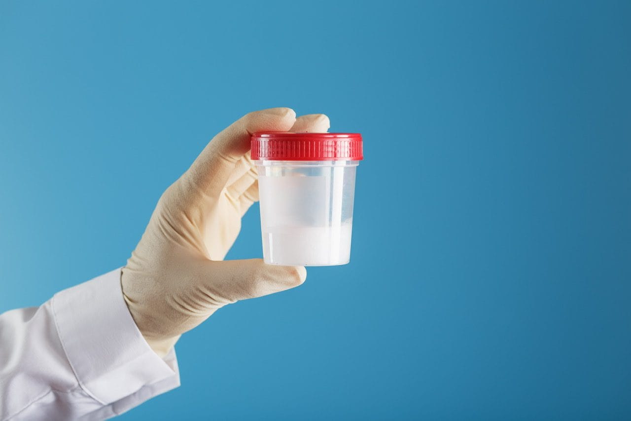 SPERMOGRAMA - analize in infertilitatea masculina (1) - Doctor MiT