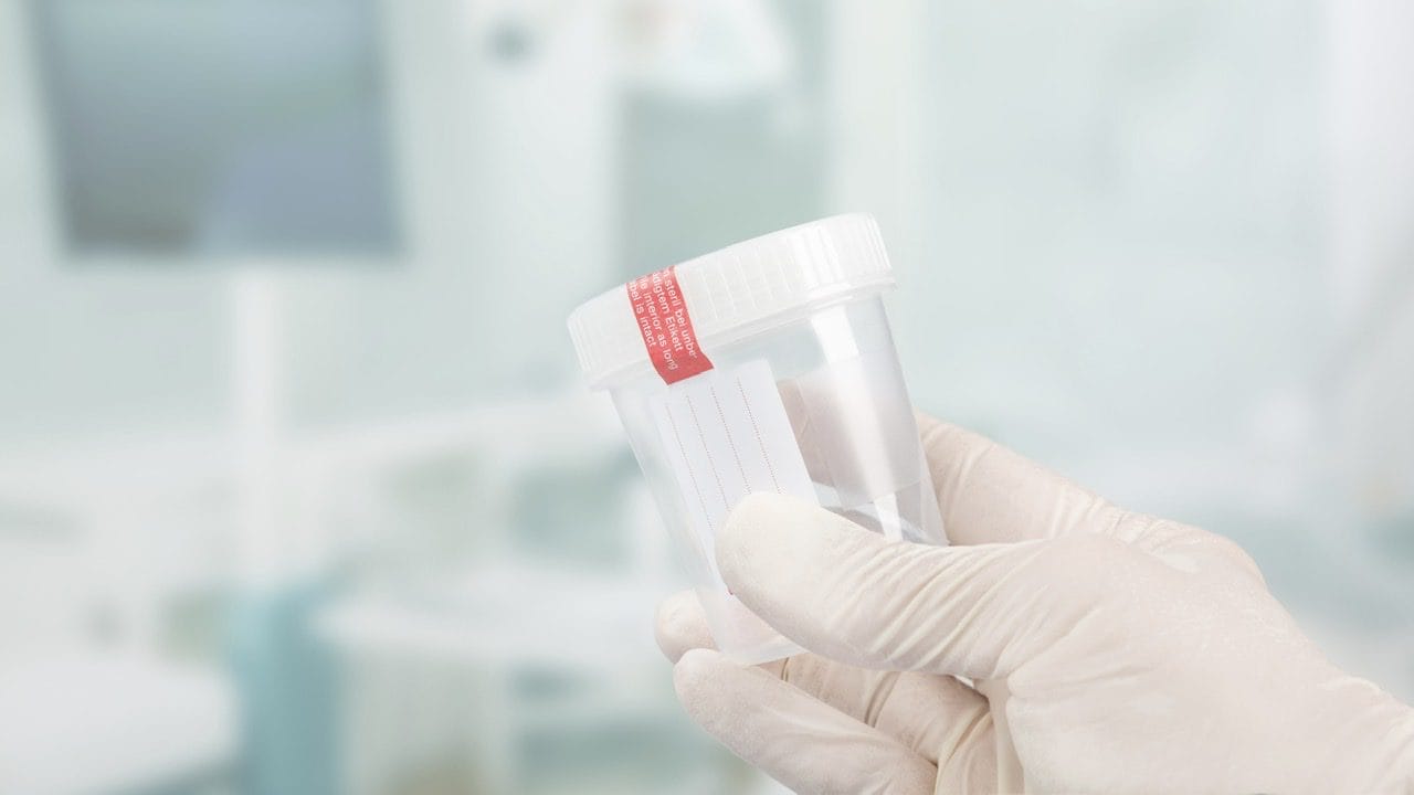 SPERMOGRAMA - analize in infertilitatea masculina (1) - Doctor MiT